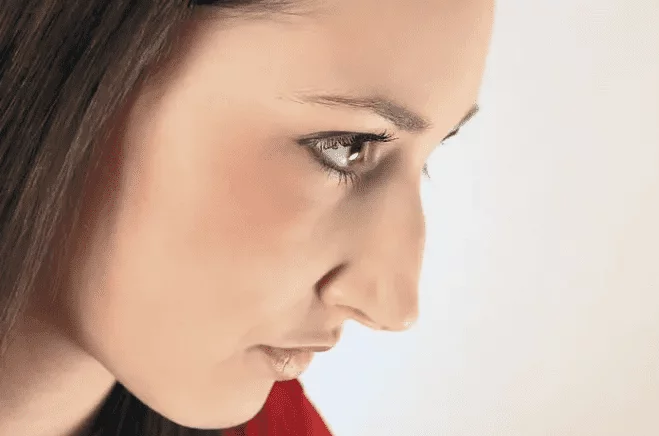 Comment corriger un nez crochu ? Solutions médicales